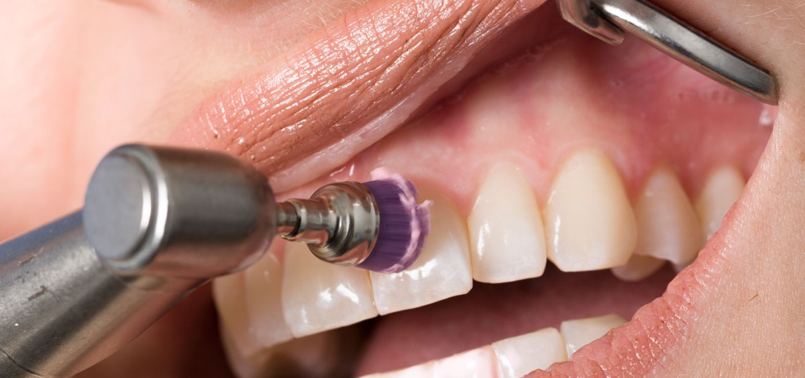 prophylaxe_neu - Zahnarzt Dr. Bischof